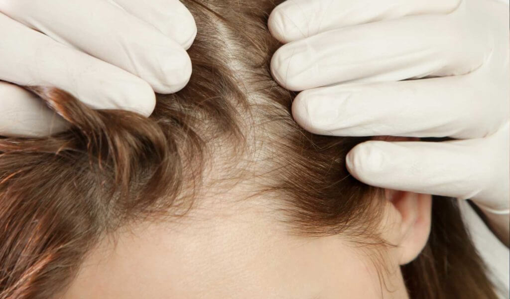 Haaranalyse: TrichoScan® – Hautarztzentrum Bremen-Süd